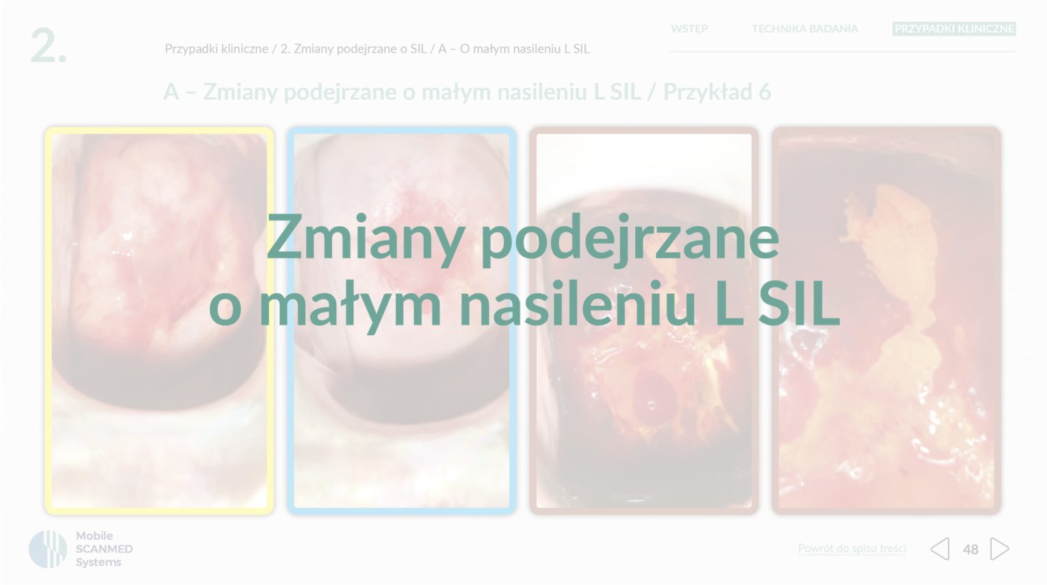 Atlas kolposkopowy – Mobile SCANMED Systems